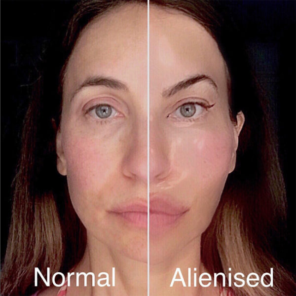 The Smackdown on Lip Augmentations | New York Social Diary